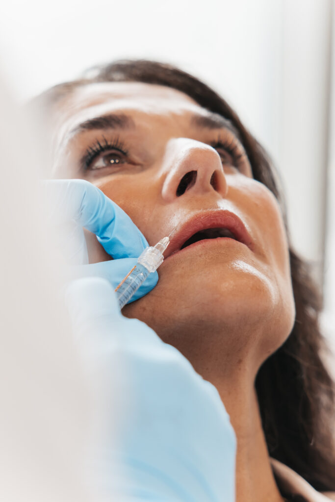 Baby Botox: een subtiele aanpak voor een verjongende look